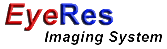 Diamond System - TelScreen