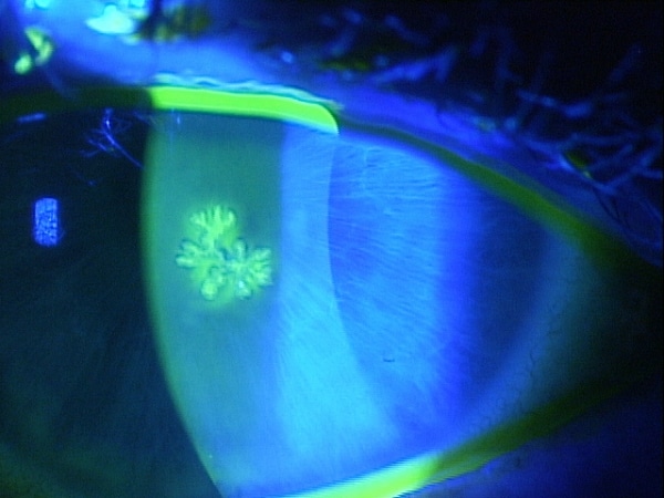 Platinum System - TelScreen