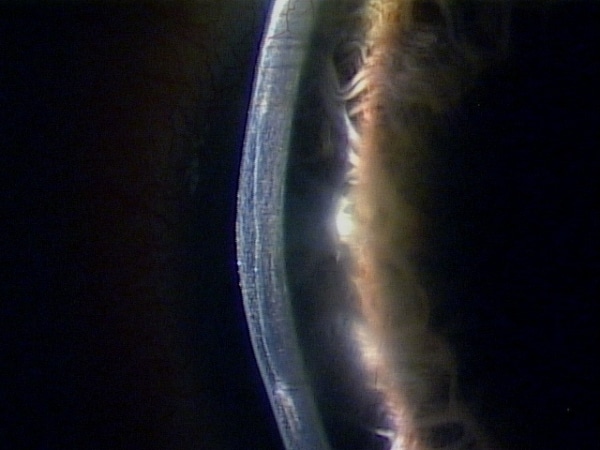 Platinum System - TelScreen