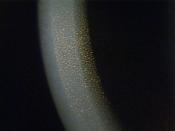 Platinum System - TelScreen