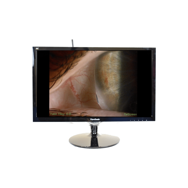 TelScreen Home - TelScreen