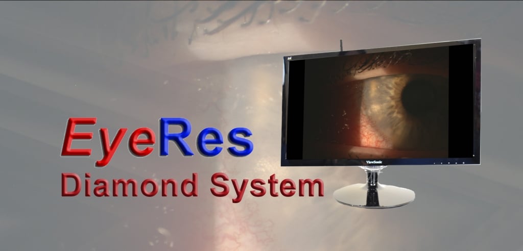 TelScreen Nears Human Eye Resolution with New Diamond System - TelScreen